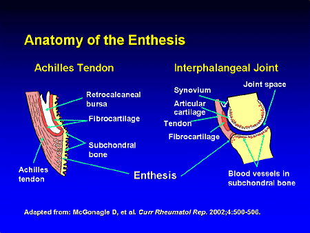 New Horizons in TNF Inhibition - Topic 2: Targeting Psoriatic Arthritis