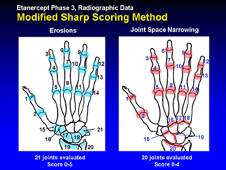 New Horizons in TNF Inhibition - Topic 2: Targeting Psoriatic Arthritis
