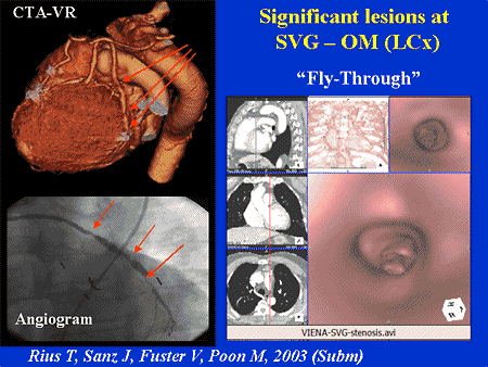 Therapeutic Challenges in the Treatment of Cardiovascular Diseases ...