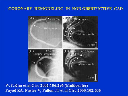 Therapeutic Challenges in the Treatment of Cardiovascular Diseases ...