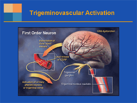 How Can We Achieve the Fastest Therapeutic Response for Migraine?