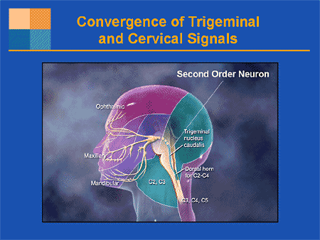 How Can We Achieve the Fastest Therapeutic Response for Migraine?