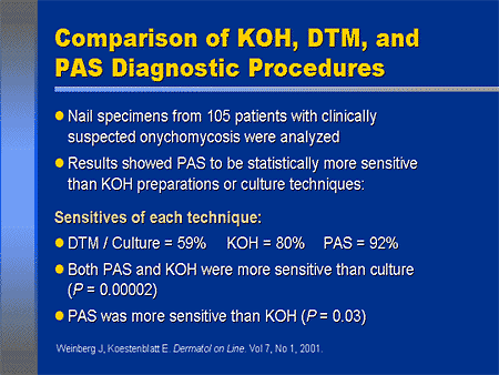 Fungal Nail Infections: Treating From Head To Toe