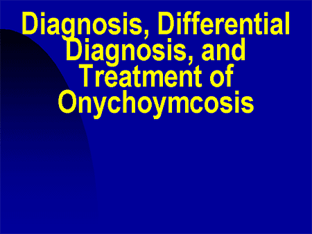 Fungal Nail Infections: Treating From Head To Toe