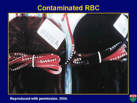 Infections in Patients With Hematologic Malignancies: Meeting the Challenge