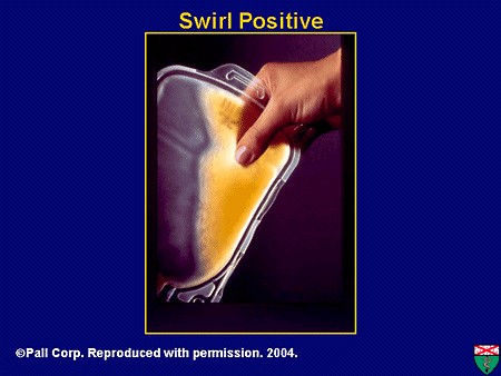 Infections in Patients With Hematologic Malignancies: Meeting the Challenge