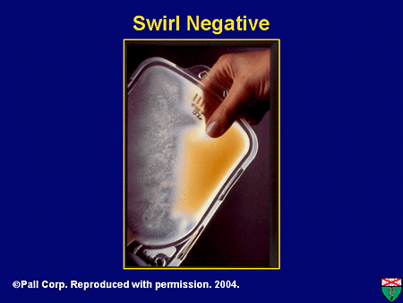 Infections in Patients With Hematologic Malignancies: Meeting the Challenge