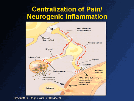 Effective Opioid Therapies Across The Spectrum Of Chronic Pain