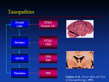 Current Alzheimer's Disease Treatments and Beyond: Advances Impacting ...