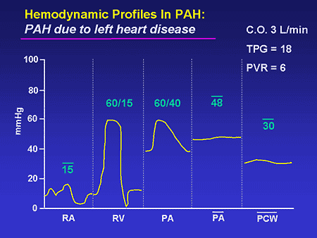 The Art and Science of the Right Heart: Diagnosis and Treatment of ...