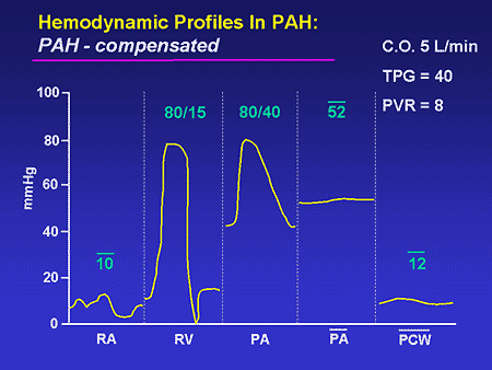 The Art and Science of the Right Heart: Diagnosis and Treatment of ...
