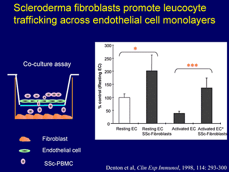 Systemic Sclerosis: An Integrated Approach to Understanding ...
