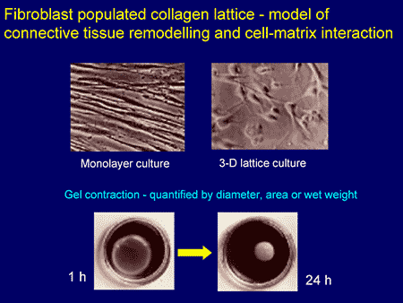 Systemic Sclerosis: An Integrated Approach to Understanding ...