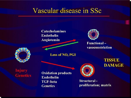 Systemic Sclerosis: An Integrated Approach to Understanding ...