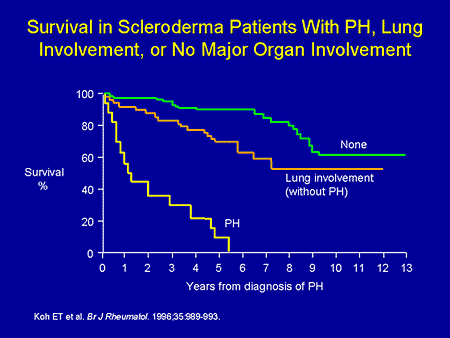 Systemic Sclerosis: An Integrated Approach to Understanding ...