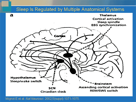 Exploring the True Morbidity of Insomnia
