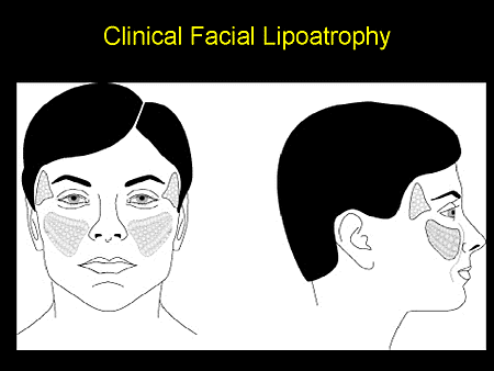 The Aging Face: More Than Skin Deep