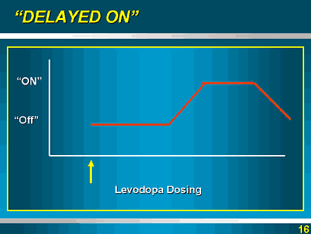 Levodopa-Continuous Dopaminergic Stimulation in the Treatment of ...
