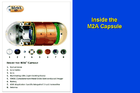 Hot Topics in Gastroenterology: Management of Nonselective NSAID ...