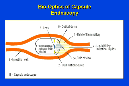 Hot Topics in Gastroenterology: Management of Nonselective NSAID ...