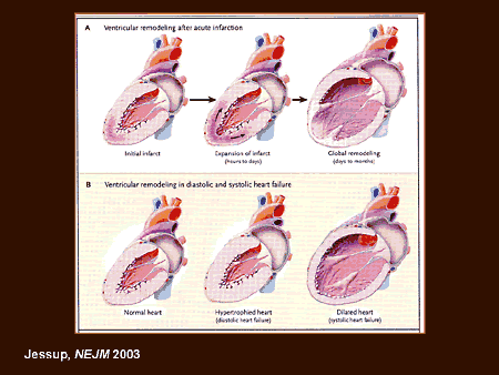Novel Therapies for Heart Failure: Expanding the Role of Natriuretic ...