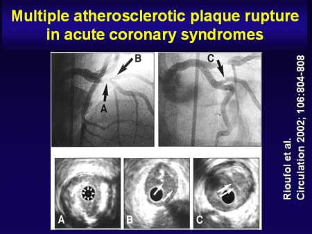 New Issues and New Therapeutic Strategies for the Long-term Management ...