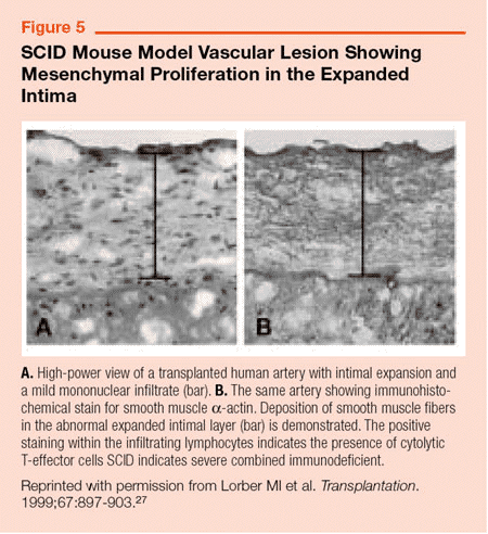 Modifiable and Nonmodifiable Donor and Recipient Factors as Targets for ...