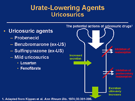 Hyperuricemia and Gout