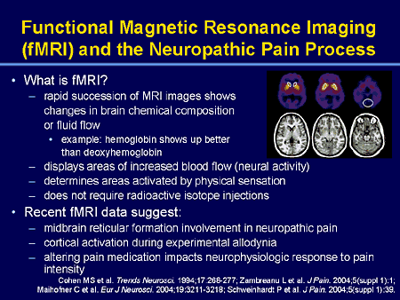 Neuropathic Pain: New Strategies to Improve Clinical Outcome