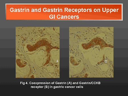 The Essentials of GI Malignancies: Maximizing the Therapeutic Potential