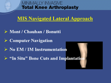 Clinical Counterpoints: New Techniques in Total Knee Arthroplasty and ...