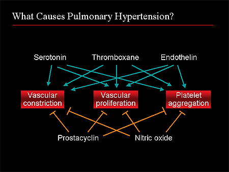 Mechanisms and Evidence-Based Management of Pulmonary Arterial ...