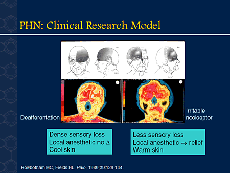 Novel Approaches to the Understanding and Treatment of Neuropathic Pain
