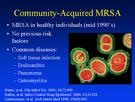 The Changing Epidemiology of Gram-Positive Infections: Community ...