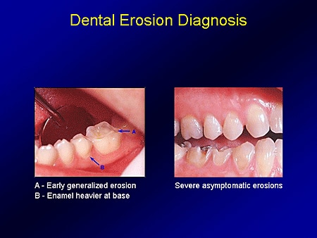 Pediatric GERD: A Problem-Based Approach to Understanding Treatment