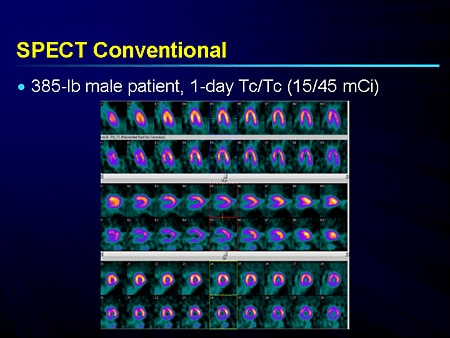 Evolving Approaches to Risk Stratification, Cardiac CT, and Attenuation ...