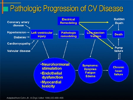 Optimizing Patient Outcome With CRT