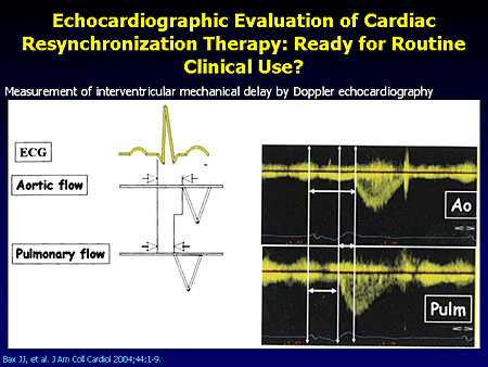 Optimizing Patient Outcome With CRT
