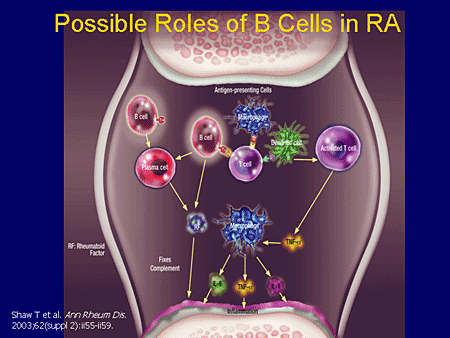 B-Cell Targeted Therapies: The Future of RA Targeted Management