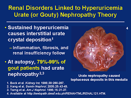 Hyperuricemia and Gout: New Clinical Insights and Emerging Treatments