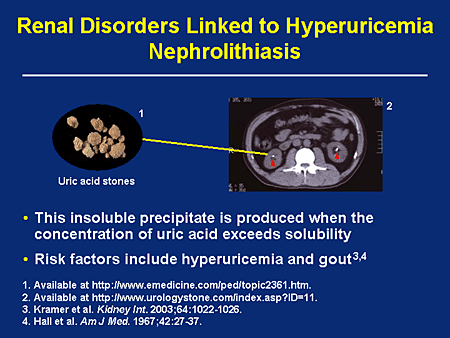 Hyperuricemia and Gout: New Clinical Insights and Emerging Treatments