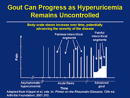 Hyperuricemia and Gout: New Clinical Insights and Emerging Treatments