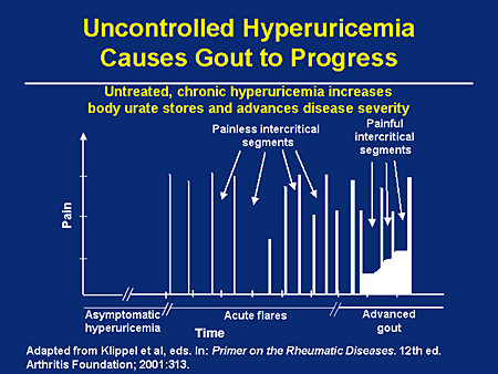 Hyperuricemia and Gout: New Clinical Insights and Emerging Treatments