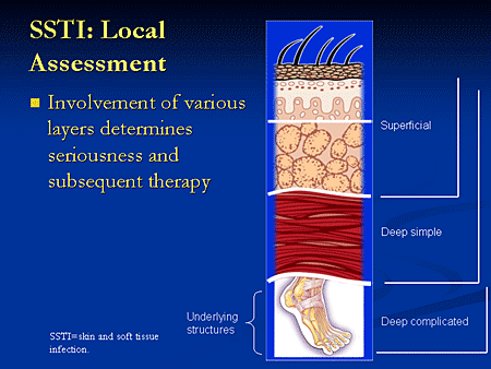 Evaluating Strategies to Improve Patient Outcomes: Community-Acquired ...