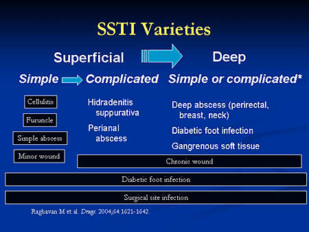 Evaluating Strategies to Improve Patient Outcomes: Community-Acquired ...