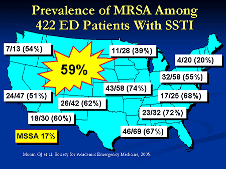 Evaluating Strategies to Improve Patient Outcomes: Community-Acquired ...