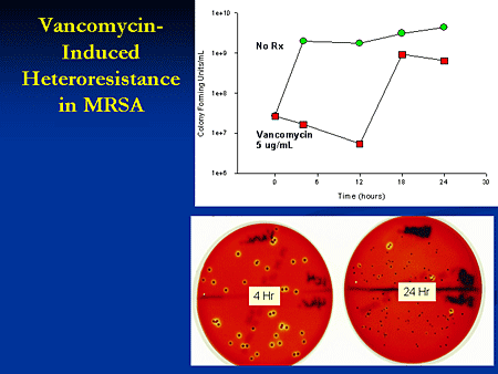 Evaluating Strategies to Improve Patient Outcomes: Community-Acquired ...