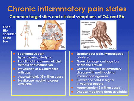 Challenging Perceptions in Chronic Pain