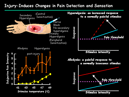 Challenging Perceptions in Chronic Pain