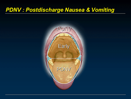 PONV Management: Tackling the Practical Issues